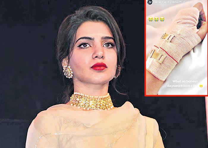 నా చెయ్యి చెబుతున్నాది! | what happened to samantha hand | Sakshi