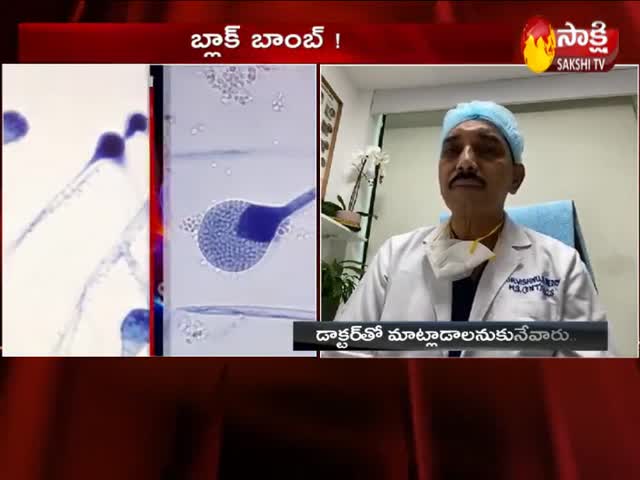 బ్లాక్ ఫంగస్‌తో 50 శాతం మరణాల రేటు ఎక్కువ | Sakshi Special Interview ...