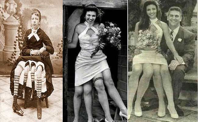 Josephine Myrtle Corbin Special Story In Telugu - Sakshi