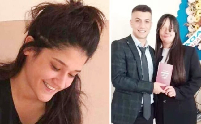 యాసిడ్‌ పోసినా ప్రేమిస్తూనే ఉంటా!.. ‘తప్పుచేశావమ్మా’ | Turkey Acid ...