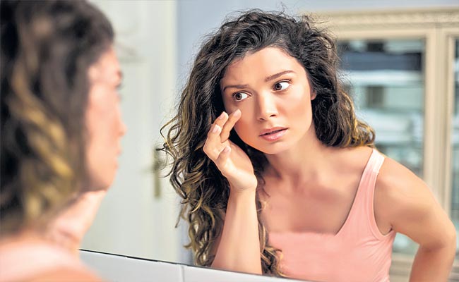 శరీరంపై మచ్చలు పోవాలంటే ఇలా చేయండి.. | White Patches On Skin: Symptoms ...