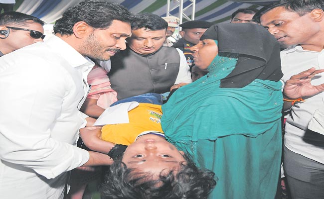 CM Jagan: చిన్నారి పరిస్థితి చూసి చలించిపోయిన సీఎం జగన్‌ | CM YS Jagan Help For Child Treatment ...