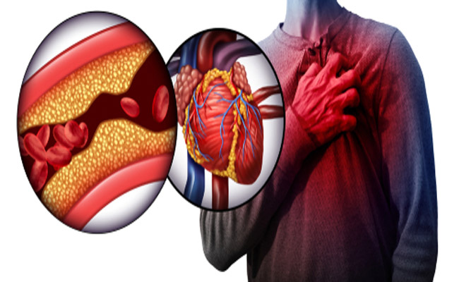 Remove Blocks In Heart With Ayurvedic Medicine, Check How To Made This ...