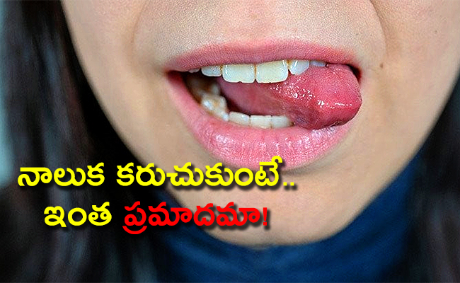 ఎంతపనైపాయే! పొరపాటున నాలుక కరుచుకుంది..అంతే ఊపిరాడక.. | Shocking ...