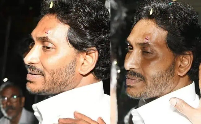 అది ప్రాణాలు తీసేంత దాడే | Strong attack on CM YS Jagan with a sharp ...