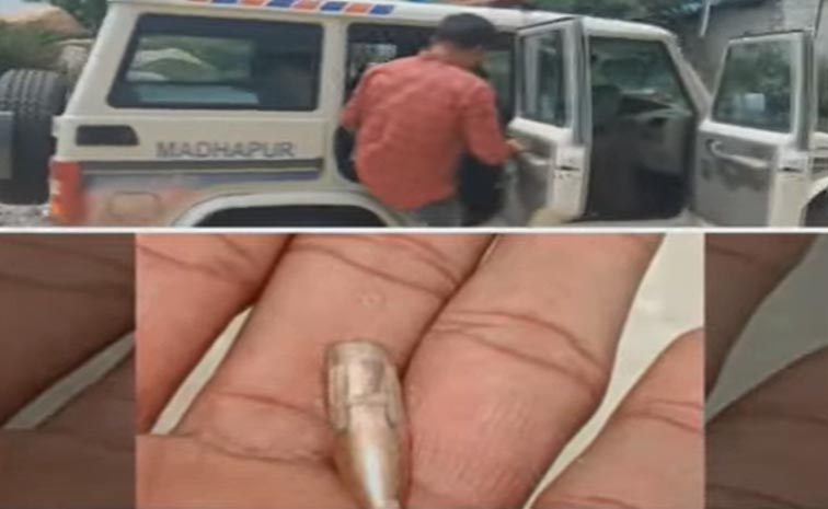 హైదరాబాద్‌: మహిళ కాలులోకి దూసుకెళ్లిన బుల్లెట్‌ | Gun Misfired And The ...