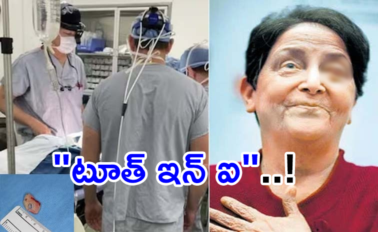 అరుదైన శస్త్రచికిత్స: దంతంతో కంటి చూపు..! | Surgeons Put Tooth In Blind ...