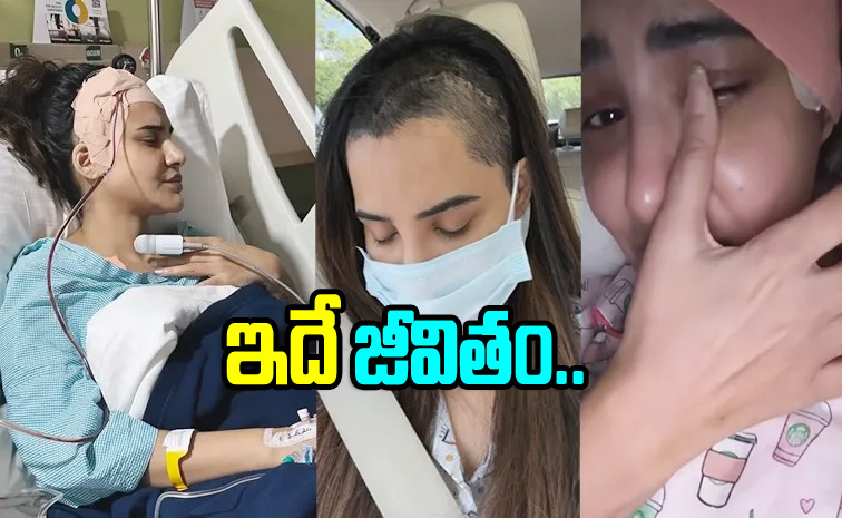 బ్రెయిన్‌ సర్జరీ.. అరగుండుతో కష్టాలు.. కన్నీళ్లు పెట్టుకున్న అషూ రెడ్డి ...