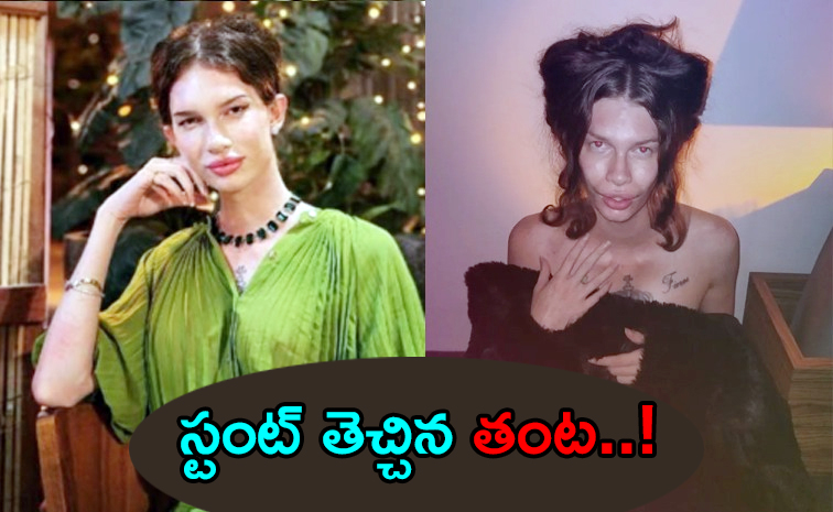 ఎంత పనైపాయే..! పిల్లిలా కనిపించాలని సర్జరీ చేయించుకుంటే చివరికి ...