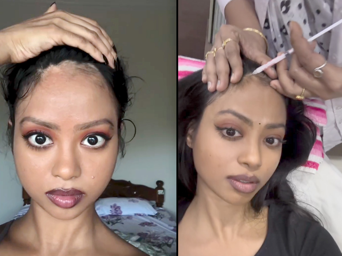 రెండు నెలలకోసారి స్టెరాయిడ్‌.. జుట్టంతా ఊడిపోతోందన్న హీరోయిన్‌ (ఫోటోలు ...