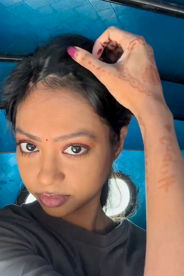 రెండు నెలలకోసారి స్టెరాయిడ్‌.. జుట్టంతా ఊడిపోతోందన్న హీరోయిన్‌ (ఫోటోలు ...